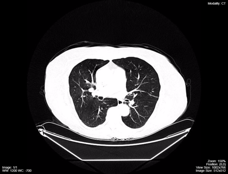 Computed Tomography (CT) – Undergraduate Diagnostic Imaging Fundamentals Computed Tomography (CT) – Undergraduate Diagnostic Imaging Fundamentals