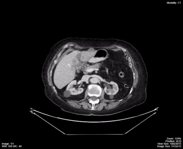 Computed Tomography (CT) – Undergraduate Diagnostic Imaging Fundamentals Computed Tomography (CT) – Undergraduate Diagnostic Imaging Fundamentals