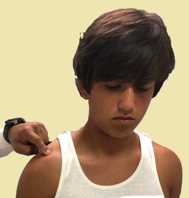 Disorders Of The Acromioclavicular Joint Orthopaedia Sports Medicine